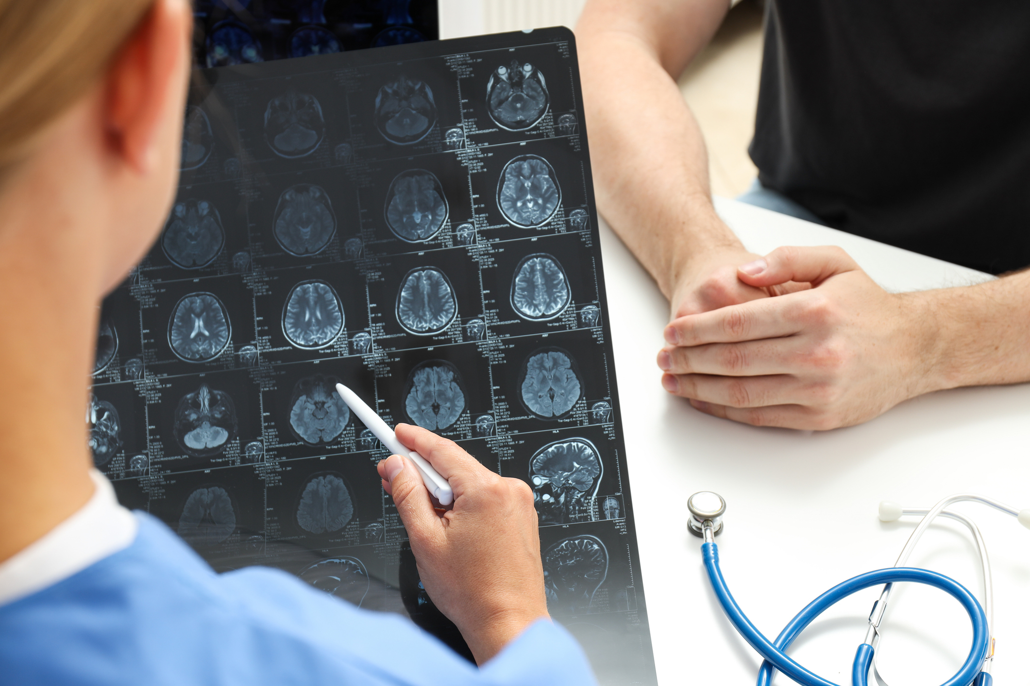 How to Know if You Have a Brain Injury Case After a Car Accident